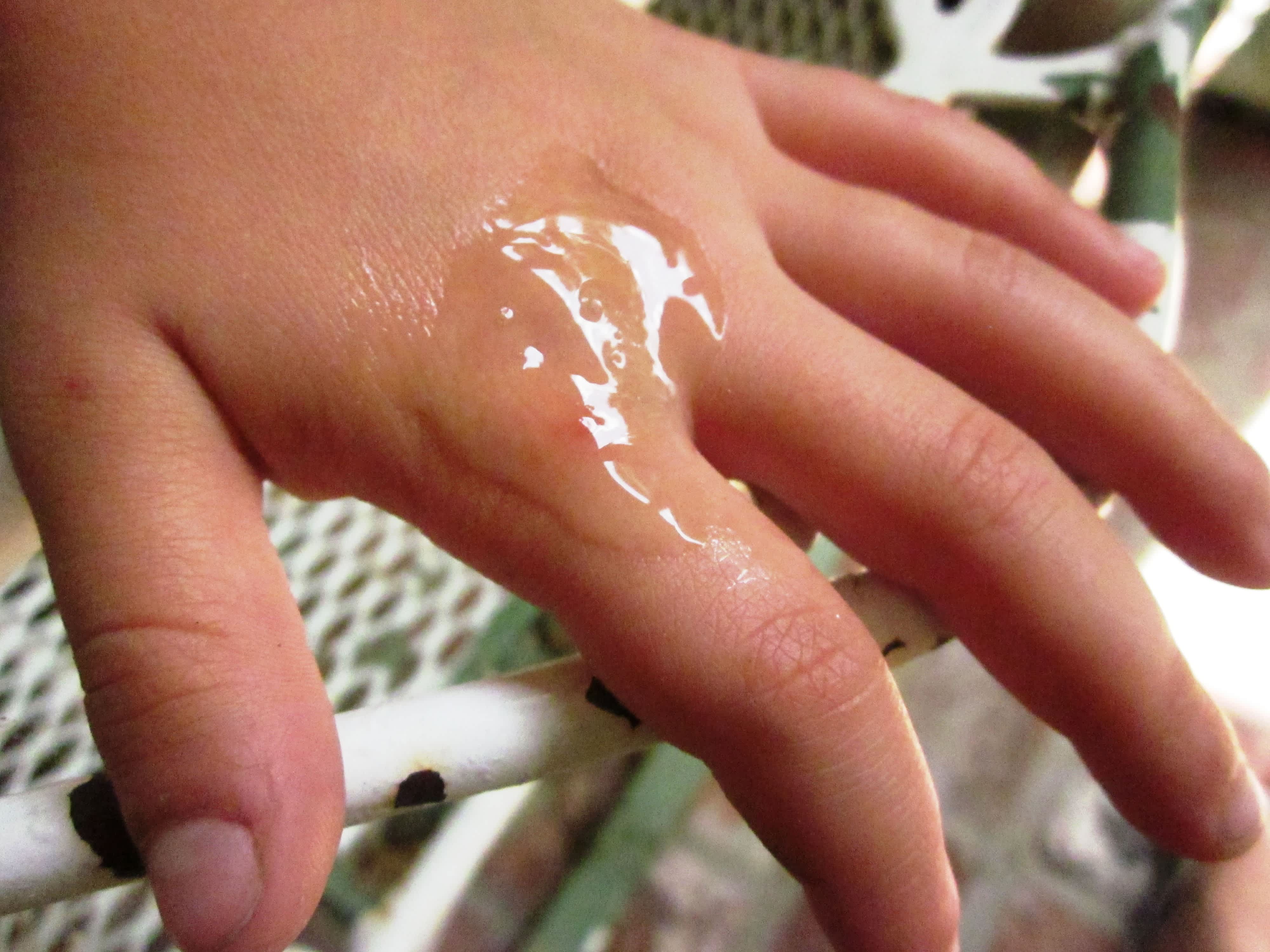 Splinter, Sliver, Stinger, Sticker & Cactus Needle Remedy Recipe - Food.com